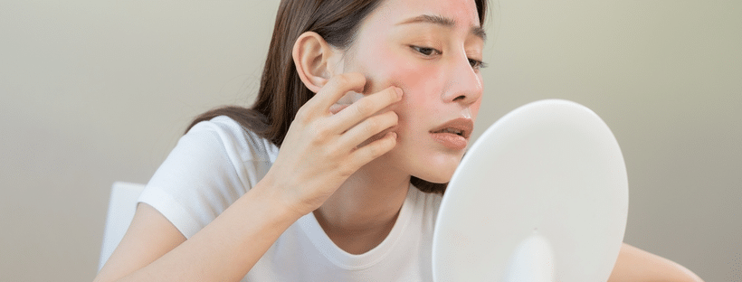 Reasons you are experiencing facial redness - Dallas Derm Center